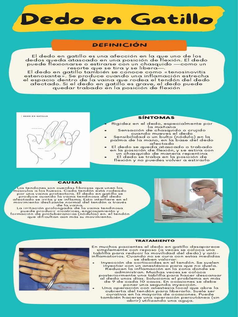 Dedo en Gatillo | PDF | Tendón | Sistema musculoesquelético