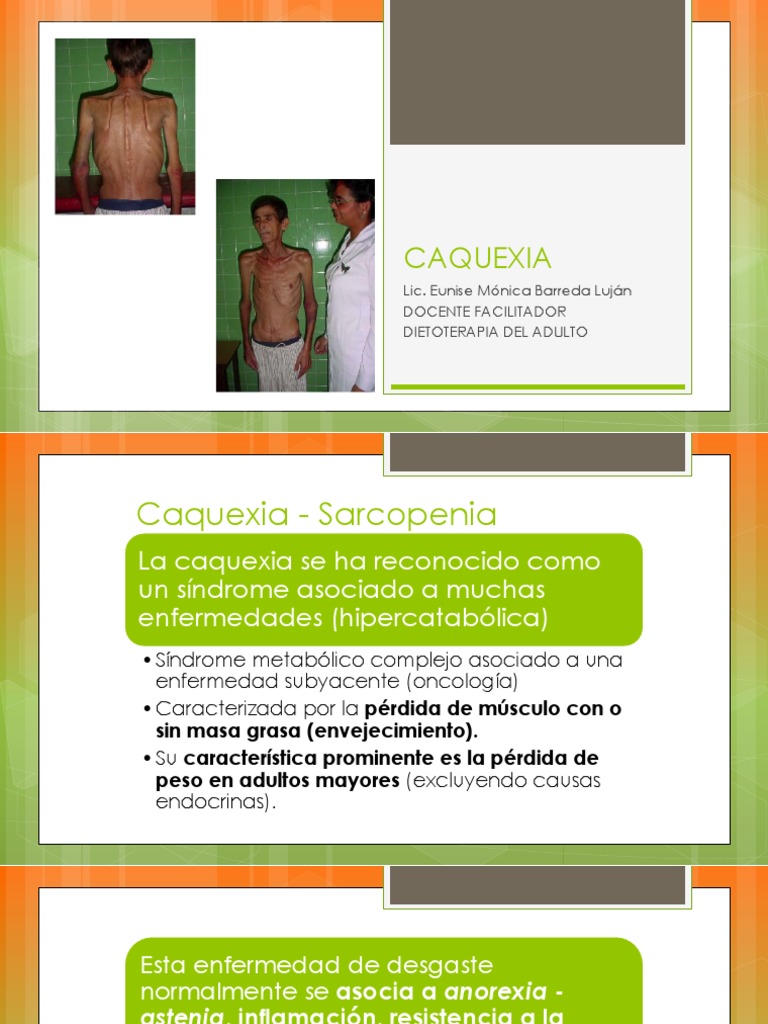 CAQUEXIA | PDF | Cáncer | Proteínas