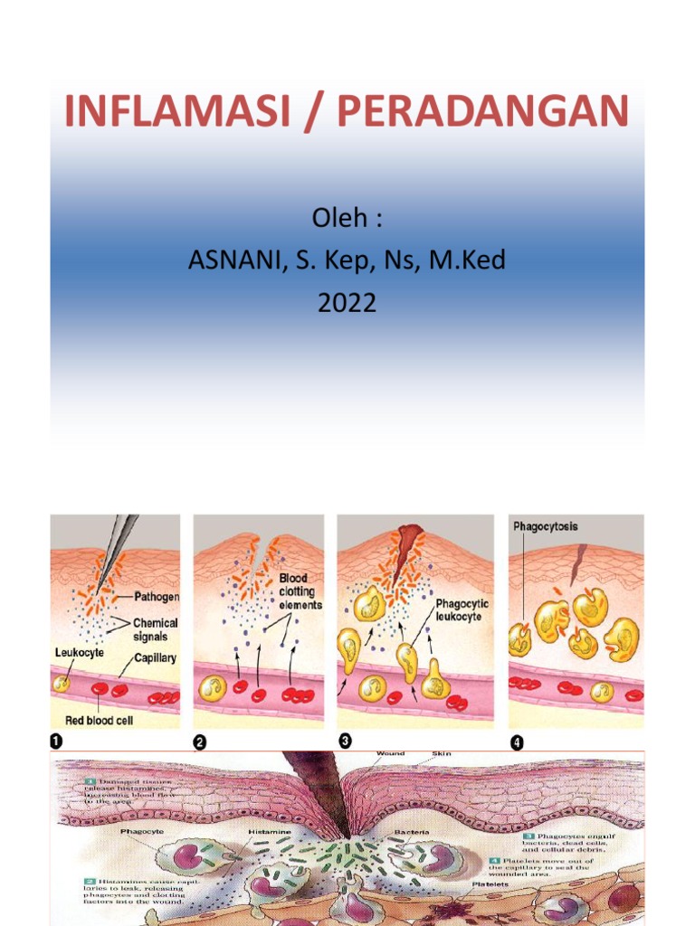 TM 3. Proses Infeksi, Peradangan Demam As 2022 | PDF