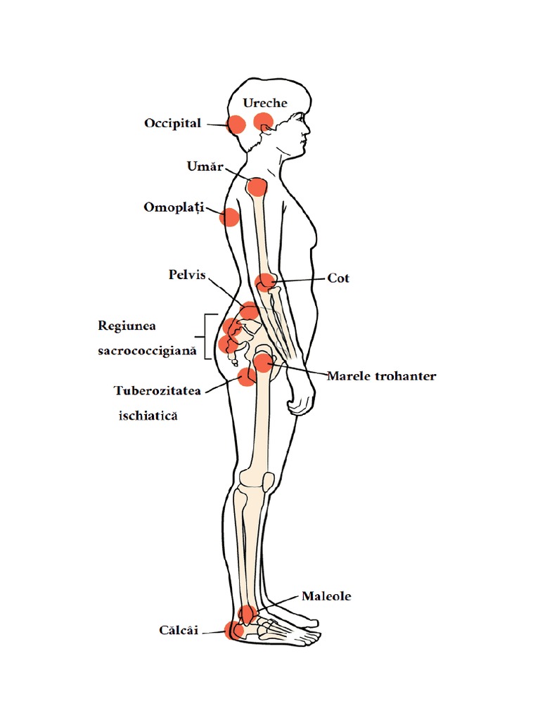 Imagine zone escare de decubitus | PDF