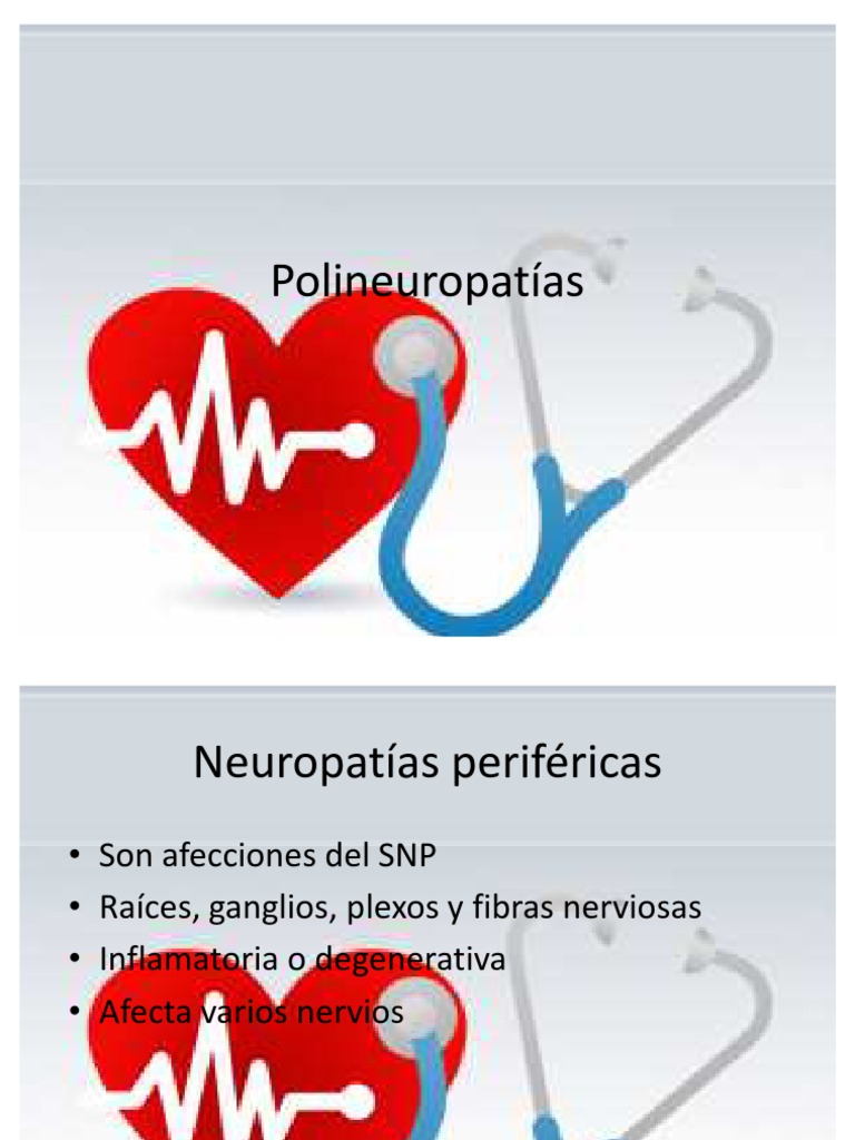 Polineuropatías | Rtt | Epidemiología | Prueba gratuita de 30 días | Scribd