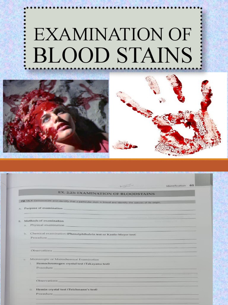Examination of Blood Stains | PDF | Blood Type | Blood