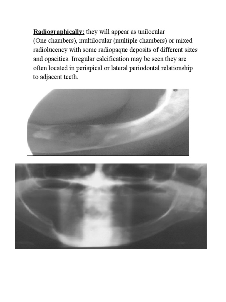 Radiographically: They Will Appear As Unilocular | PDF | Language Arts ...