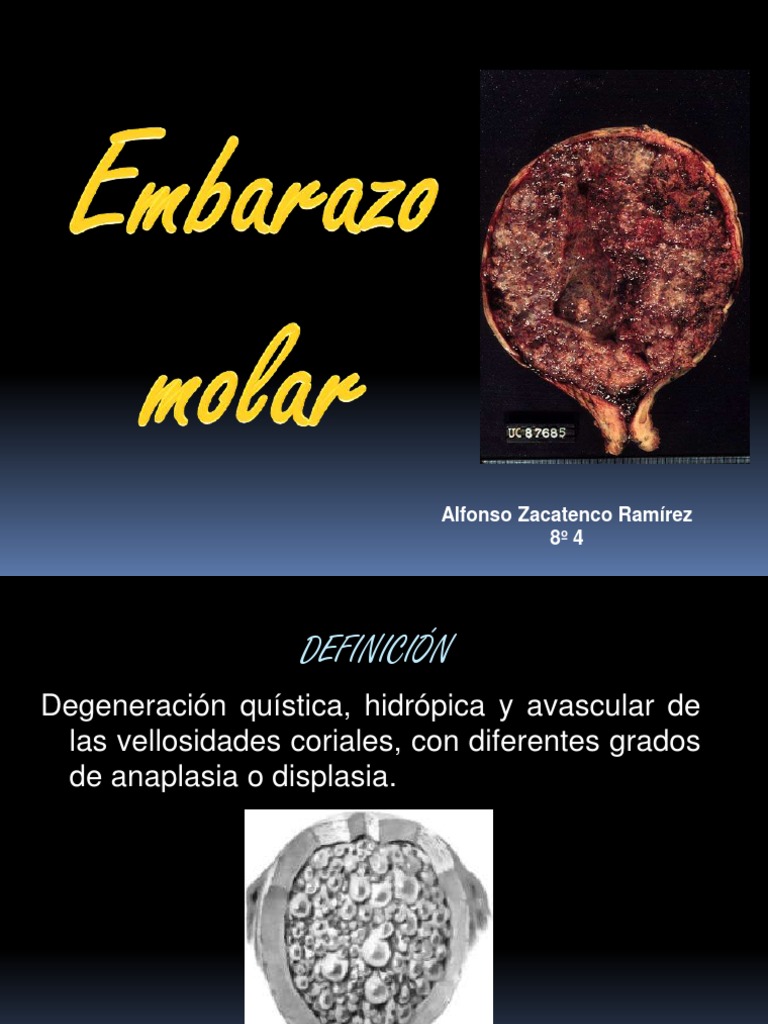Embarazo Molar | PDF | El embarazo | Anatomía