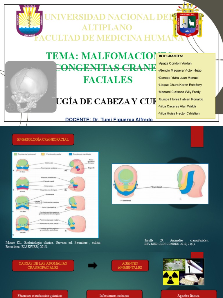 Malformaciones Congenitas Craneofaciales - Facultad de Medicina Humana-Unap | PDF | Medicina ...