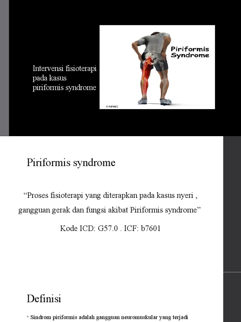 Fisioterapi untuk Sindrom Piriformis | PDF