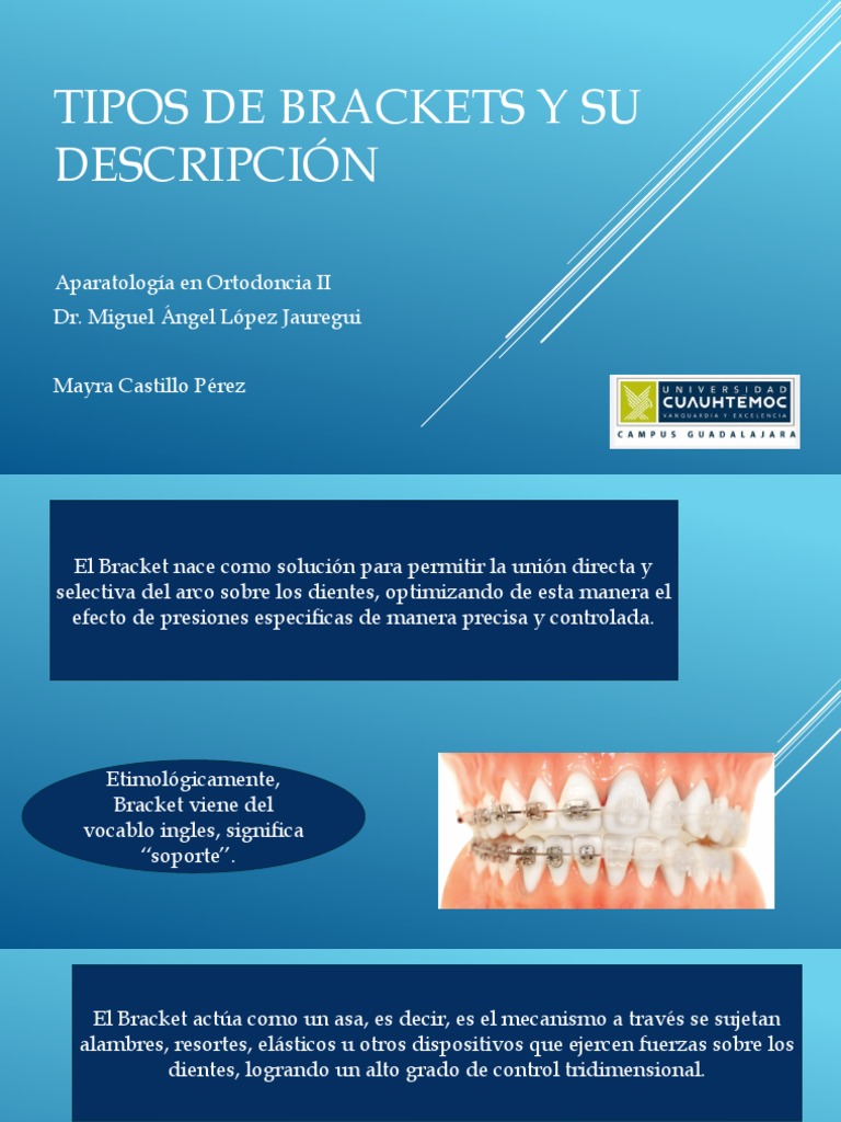 Tipos de Brackets y Su Descripción | PDF | Ortodoncia | Ramas de ...