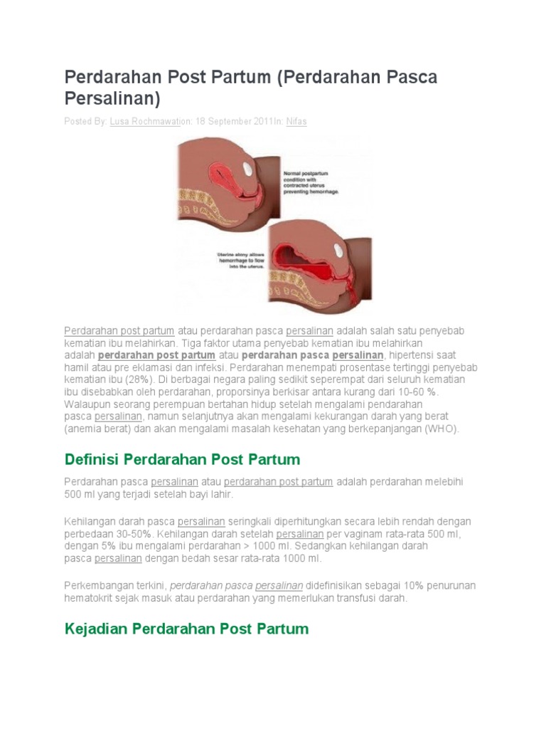 Panduan Perdarahan Pasca Persalinan | PDF