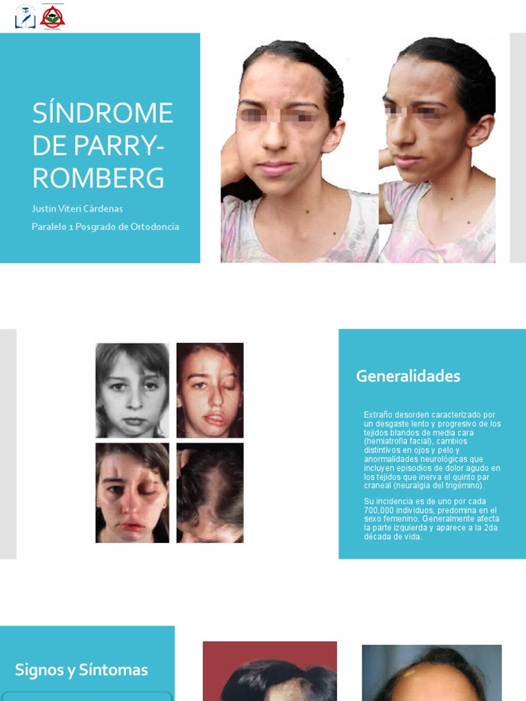 Sindrome de Parry Romberg | PDF | Epidemiología | Medicina