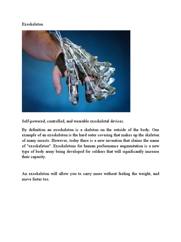 Exoskeleton Vs Endoskeleton Prosthesis