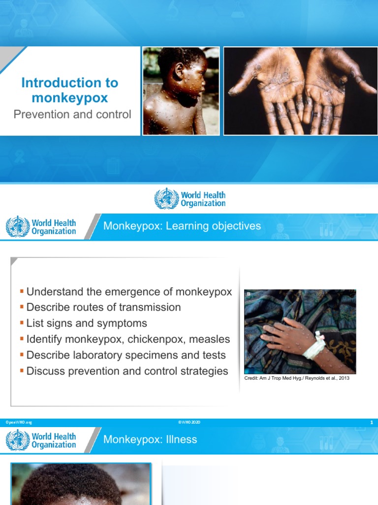 Introduction To Monkeypox: Prevention and Control | PDF | Smallpox ...