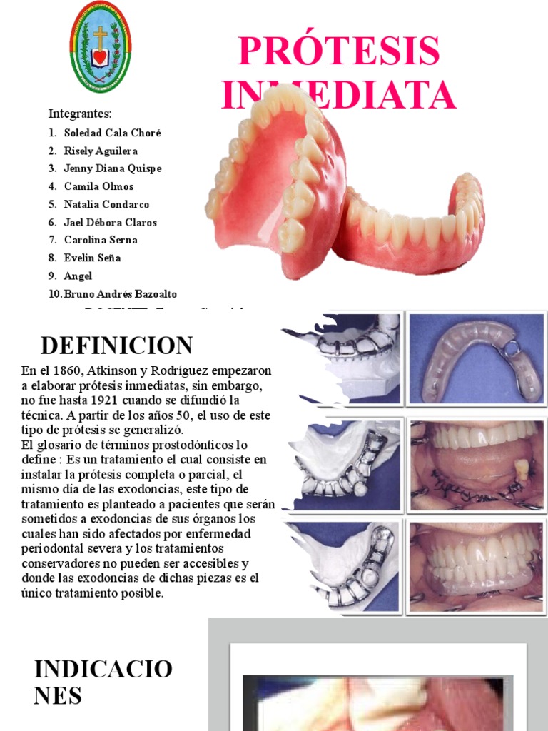 Prótesis Inmediata | PDF | Dentadura postiza | Hueso