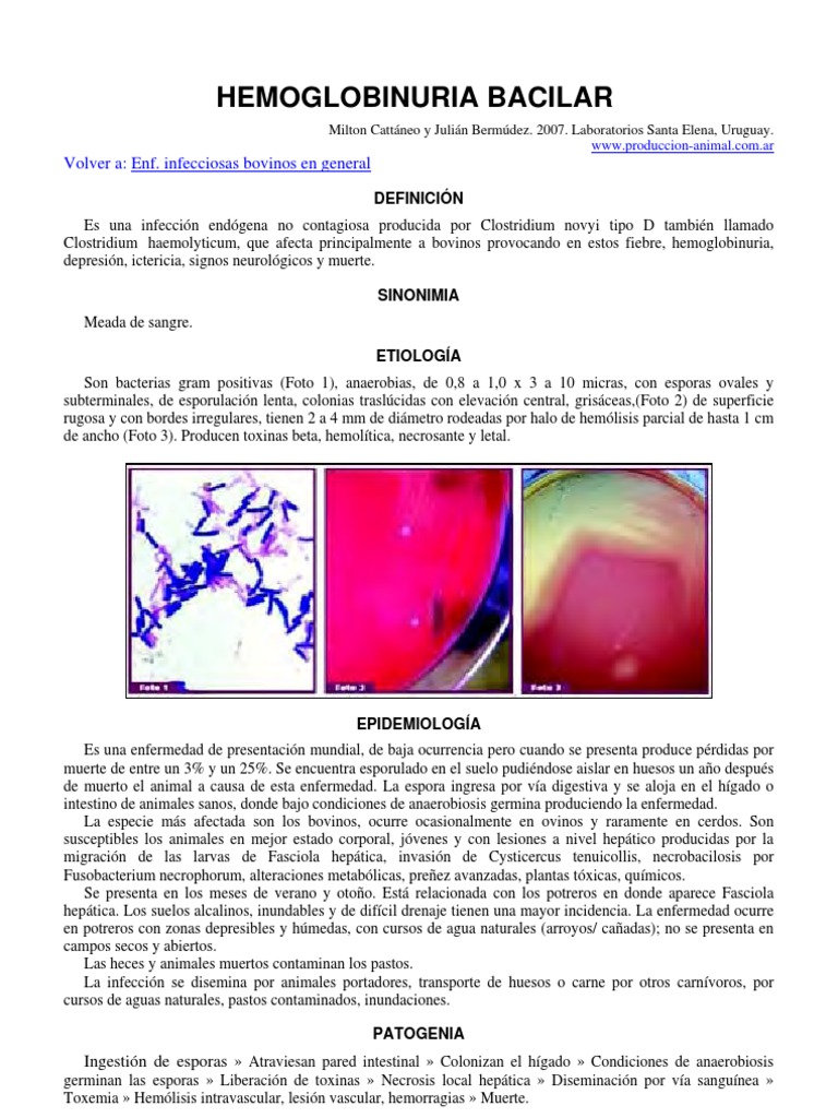 66 Hemoglobinuria | PDF | Ántrax | Especialidades Medicas