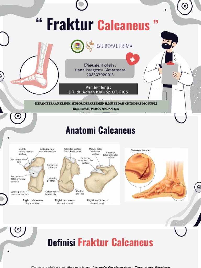 Paper Fracture Calcaneus | PDF
