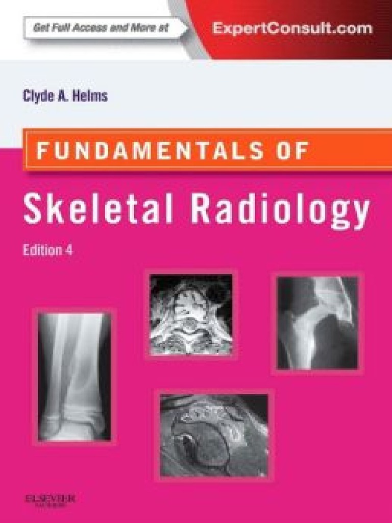 Fundamentals of Skeletal Radiology - Compress | PDF | Ct Scan ...