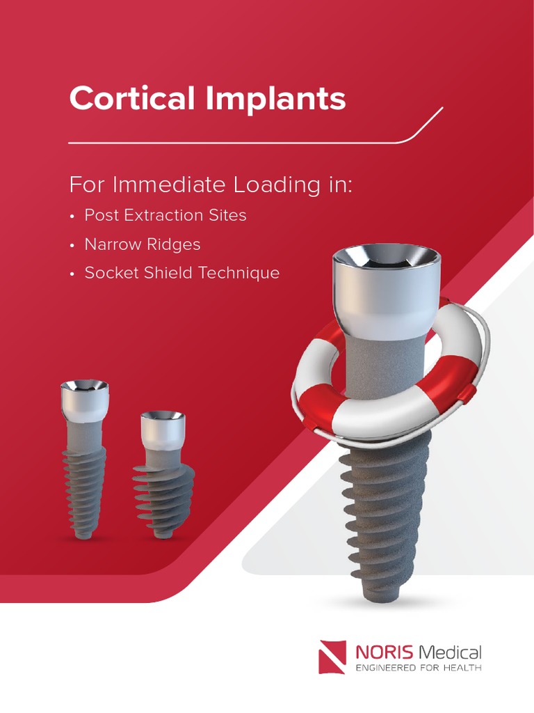 Cortical Implants Brochure | PDF | Dental Implant | Medical Specialties