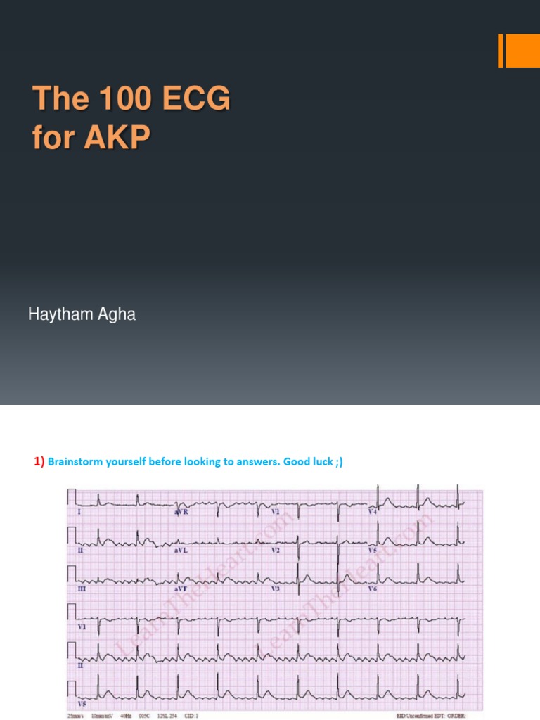 100 ECG For AKP - With Answers | PDF | Electrocardiography | Medical ...