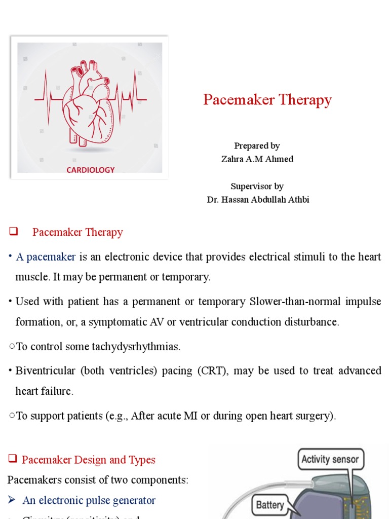 Pacemaker Therapy: Prepared by Zahra A.M Ahmed Supervisor by Dr. Hassan ...