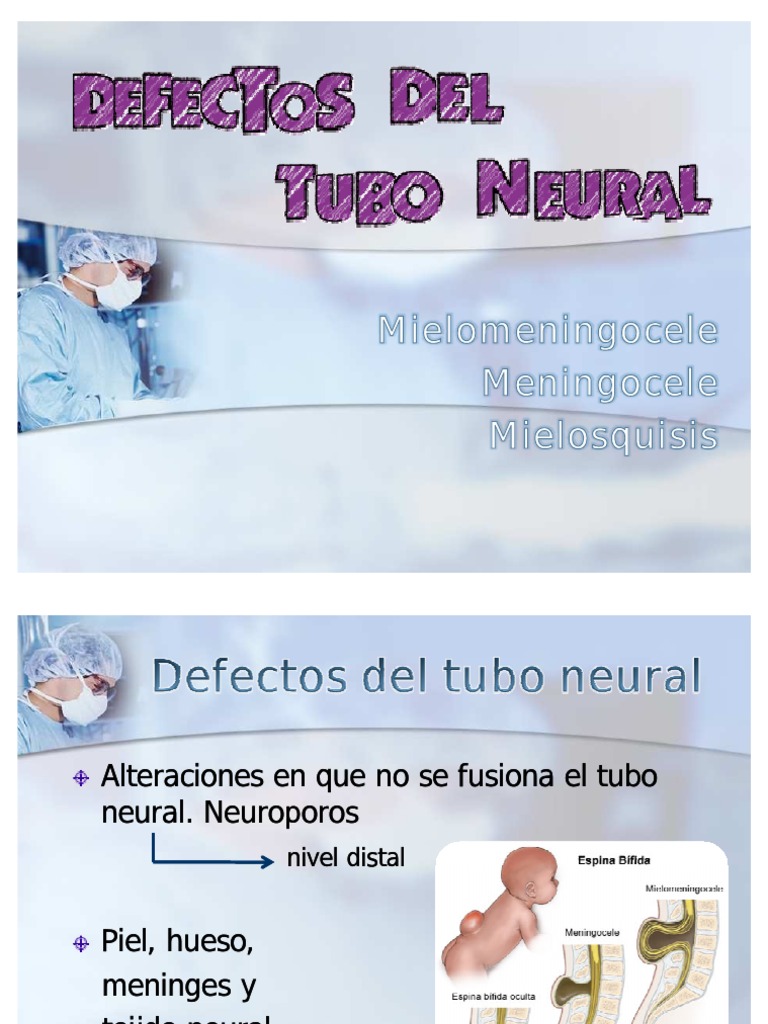 Defectos Del Tubo Neural | PDF