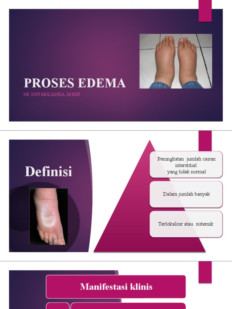 Proses Edema 2 | PDF