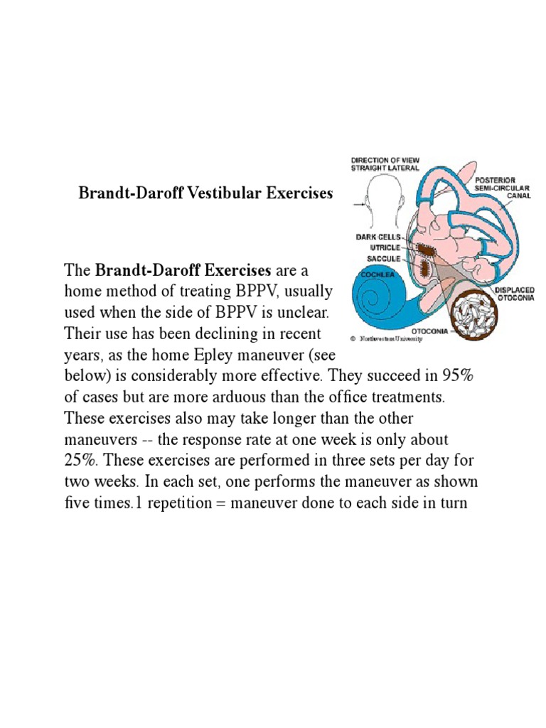 BPPV Exercises | PDF