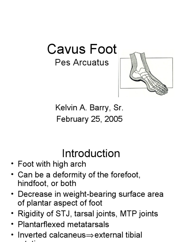Cavus Foot | Foot | Musculoskeletal System