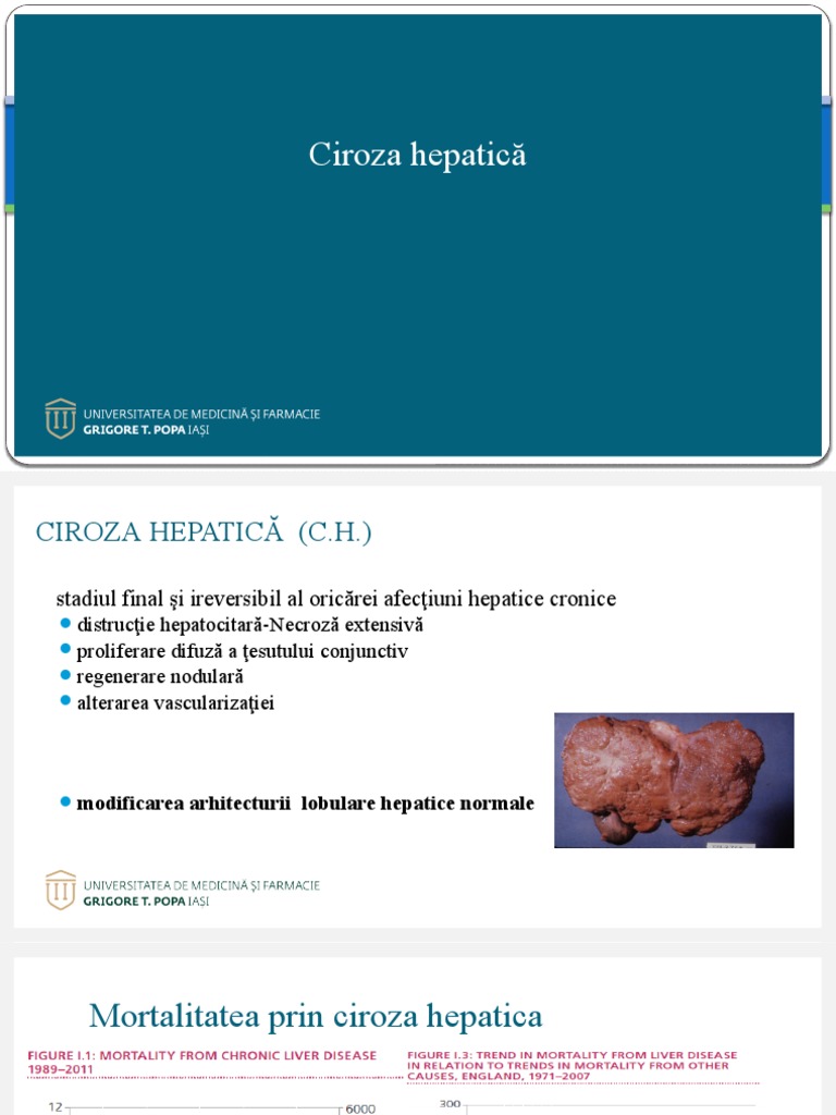 Ciroza Hepatica | PDF