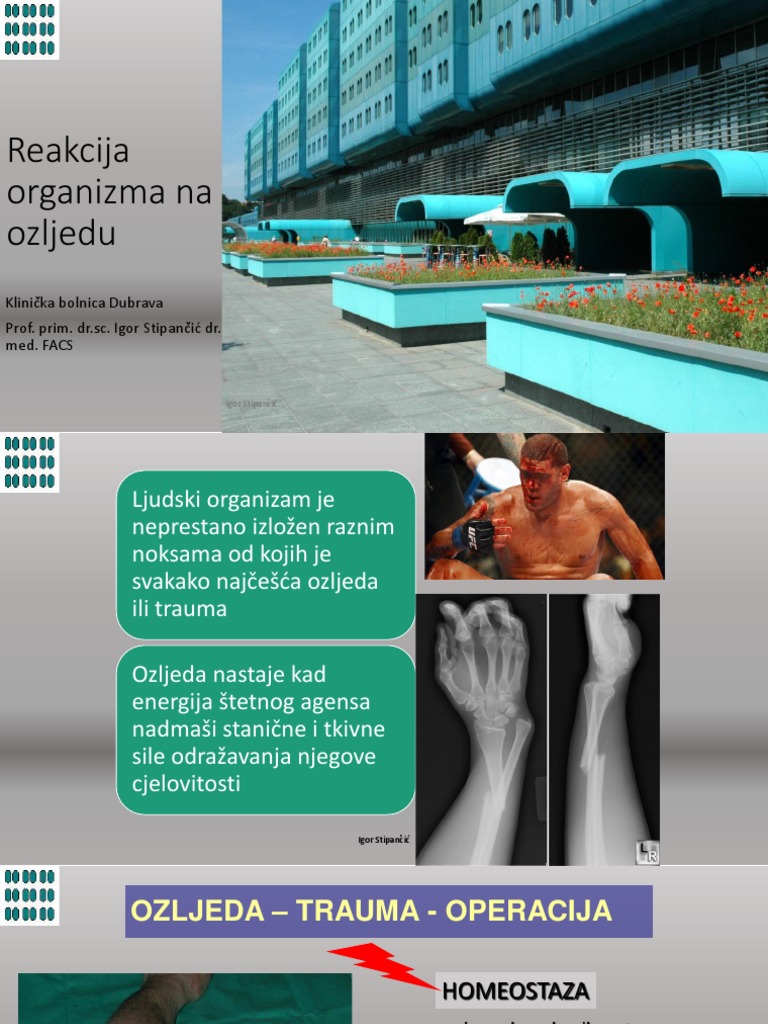 Reakcija Organizma Na Ozljedu: Klinička Bolnica Dubrava Prof. Prim. DR ...