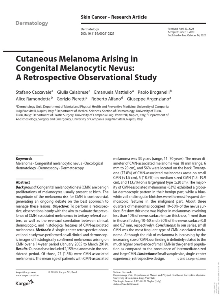 Nevo Congenito Artigo | PDF | Melanoma | Cancer