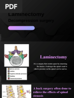 PSLD Surgery Procedure Overview | PDF | Vertebra | Anatomical Terms Of ...