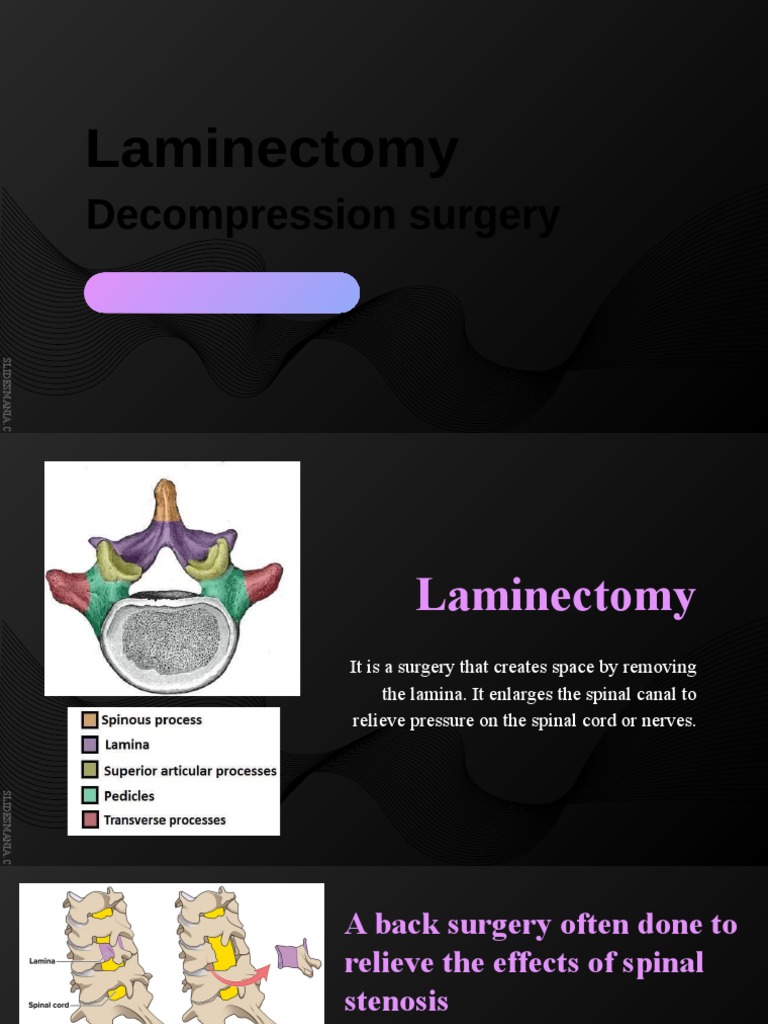 Laminectomy Procedure Explained | PDF | Vertebral Column | Vertebra