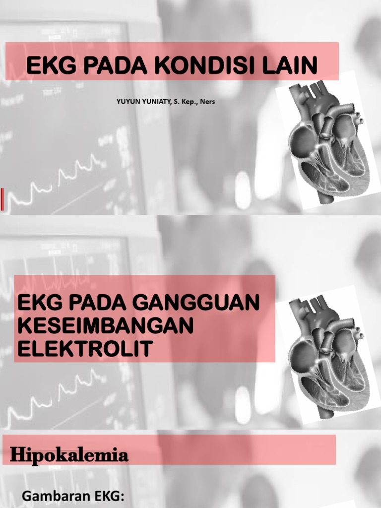 Ekg - Yuyun | PDF