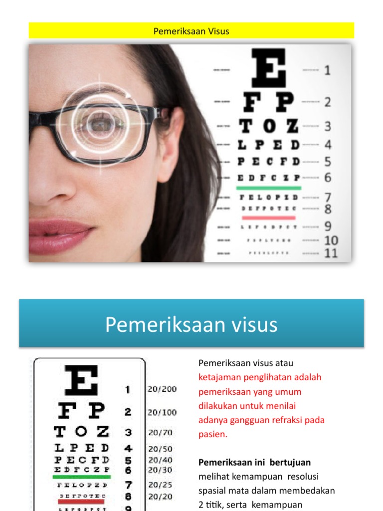 Pemeriksaan Visus | PDF