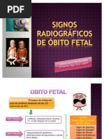 Distocia Funicular: Definición y Evaluación | PDF | Parto | Feto