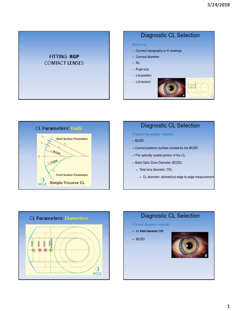 2.RGP Corneal Lens | PDF | Contact Lens | Cornea