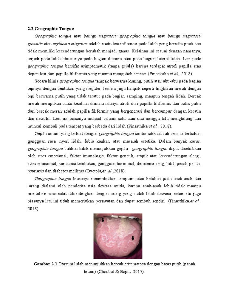 Geographic Tongue | PDF