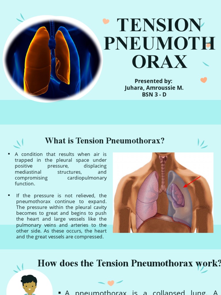 TENSION PNEUMOTHORAX | PDF | Lung | Breathing