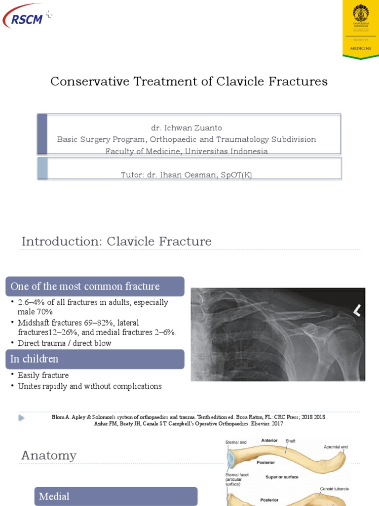 Conservative Treatment of Clavicle Fractures | PDF | Shoulder | Limbs ...