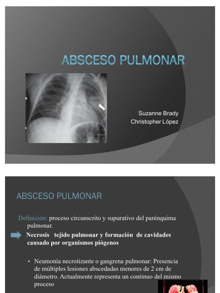 Absceso Pulmonar | PDF | Especialidades Medicas | Enfermedades y trastornos