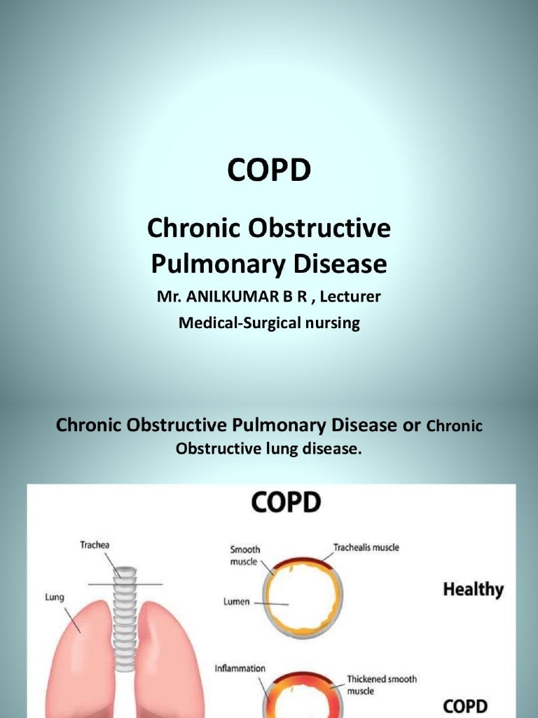 Chronic Obstructive Pulmonary Disorders Copd 79676919 | PDF