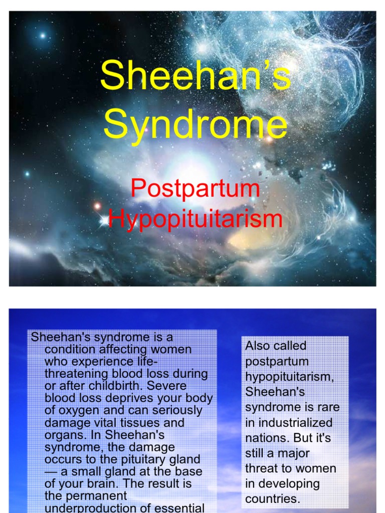 Sheehan's Syndrome | PDF