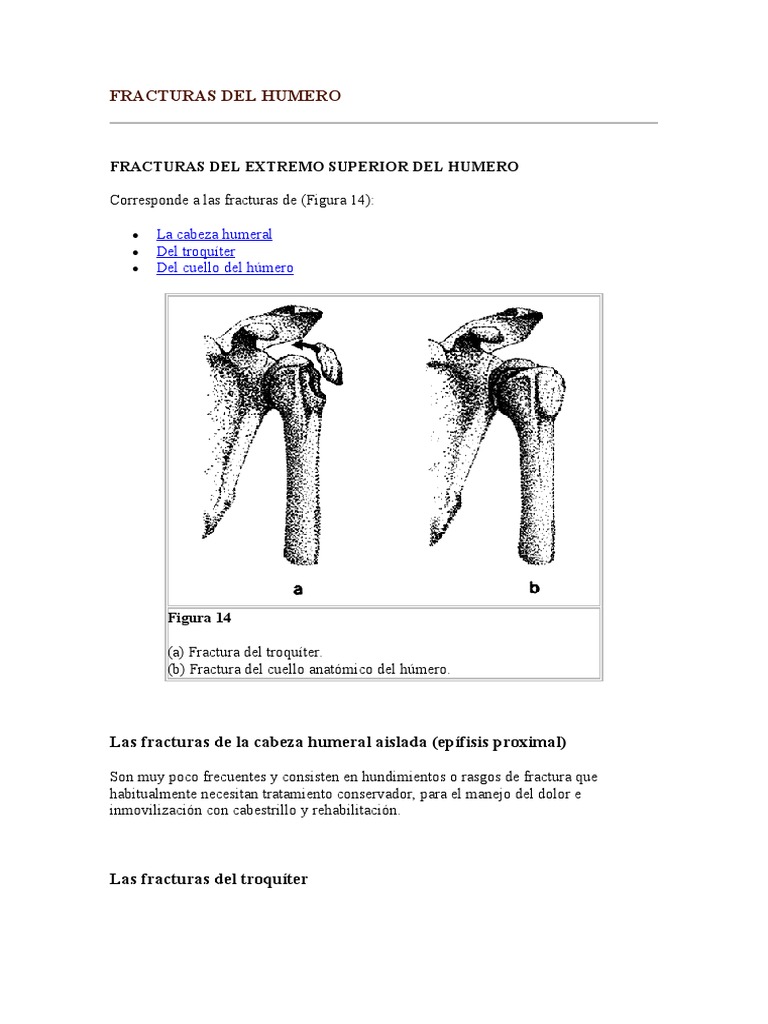 Fracturas Del Humero | PDF | Rodilla | Hombro