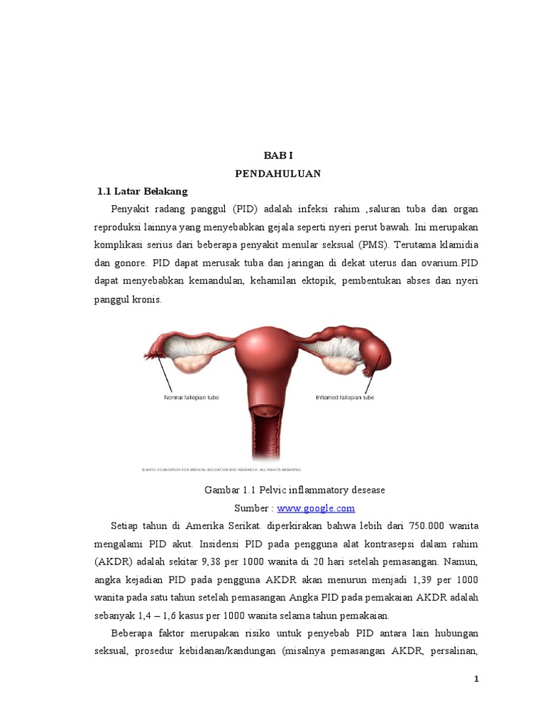 Makalah KEL 2 Pelvis Inflamatory Desease Revisi New | PDF