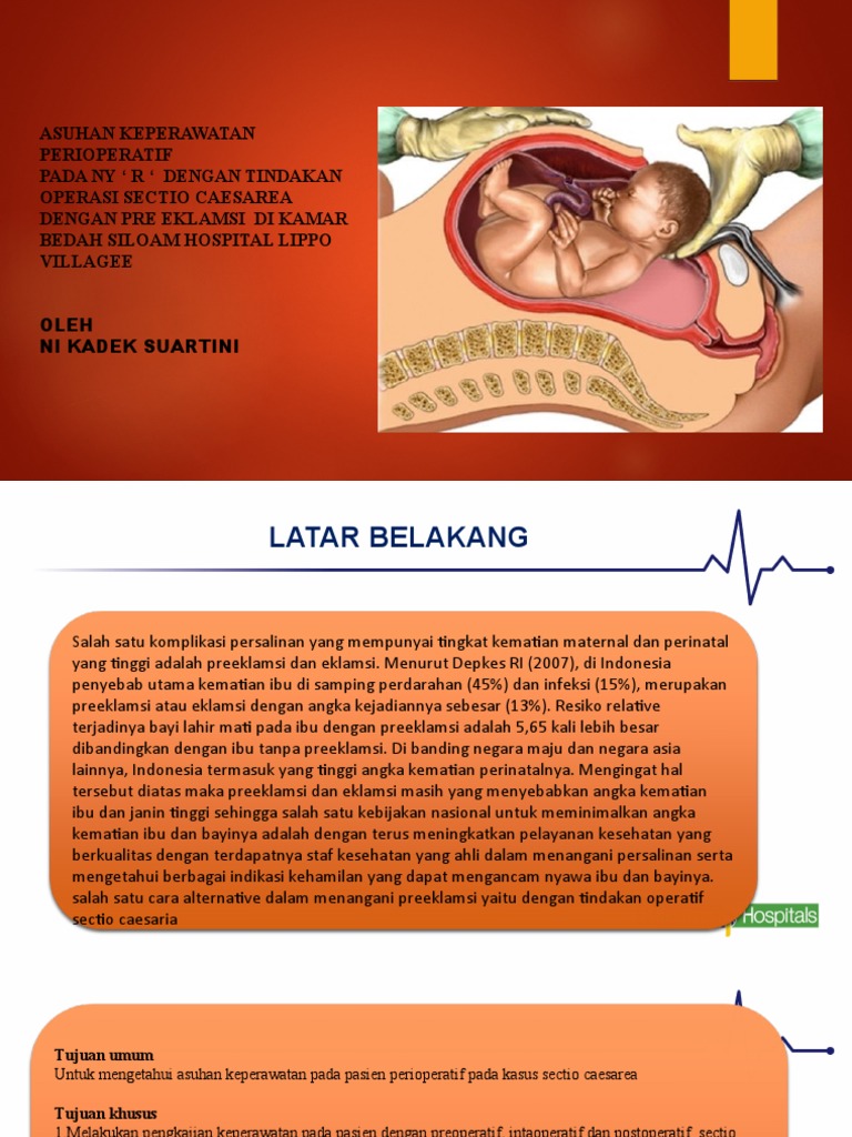 Asuhan Keperawatan Perioperatif Pada Ny R Dengan Tindakan Operasi ...