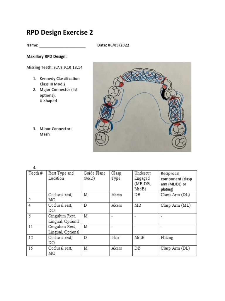 KEY RPD Design Exercise 2 | PDF