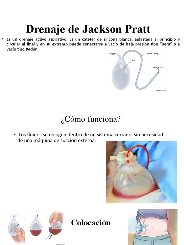 Drenaje Jackson Pratt: Uso y Función | PDF | Abdomen | Drenaje