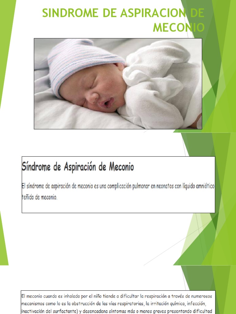 Sindrome de Aspiracion de Meconio | PDF