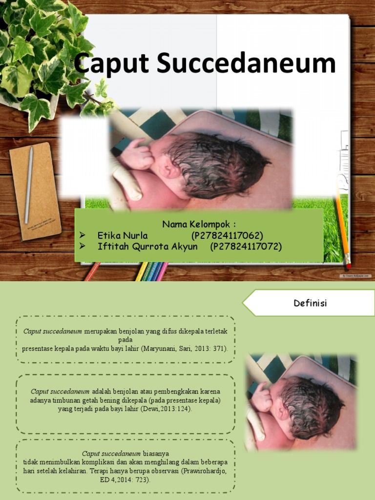 Caput Succedaneum | PDF | Kesehatan Holistik | Sains & Matematika