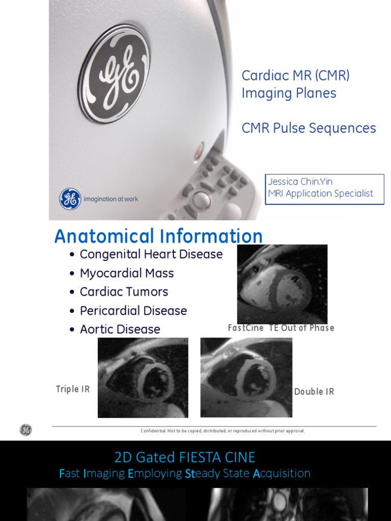 Cardiac MRI Imaging Planes Overview | PDF | Heart Valve | Ventricle (Heart)