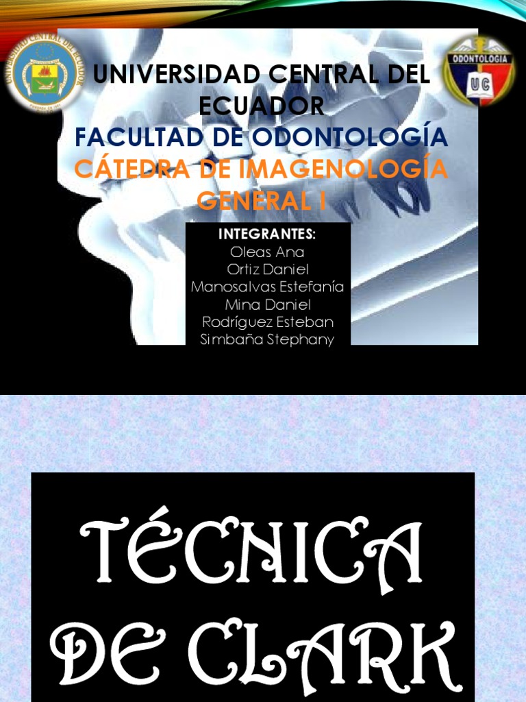 Técnica de Clark | Descargar gratis PDF | Rayo X | Radiografía